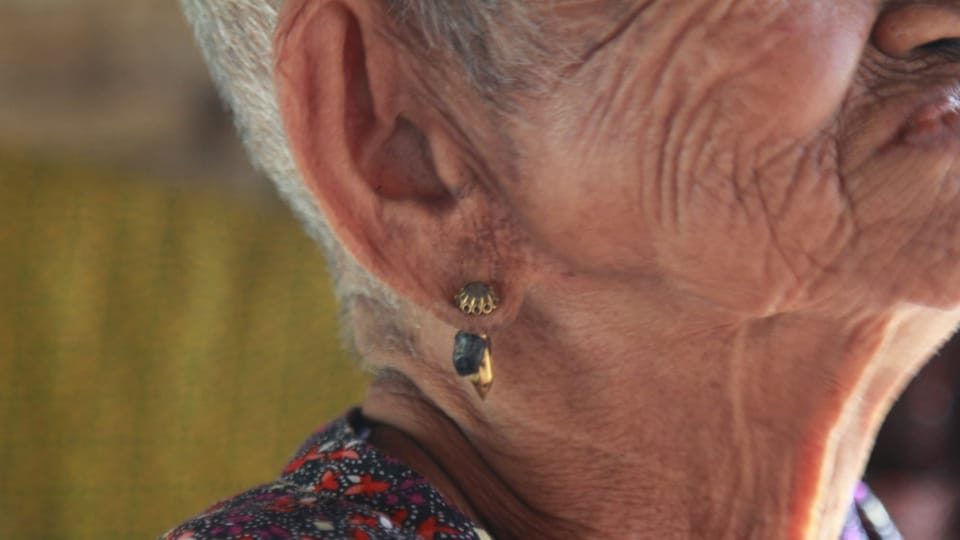 Medication Safety Training : How to Give Ear Drops